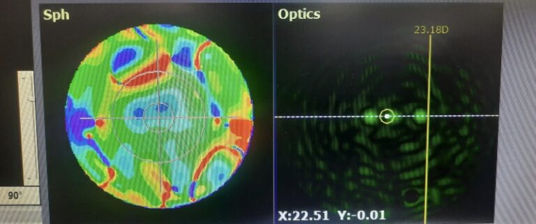 Trifocal EDOF-Intraocular lens manufacturer in India